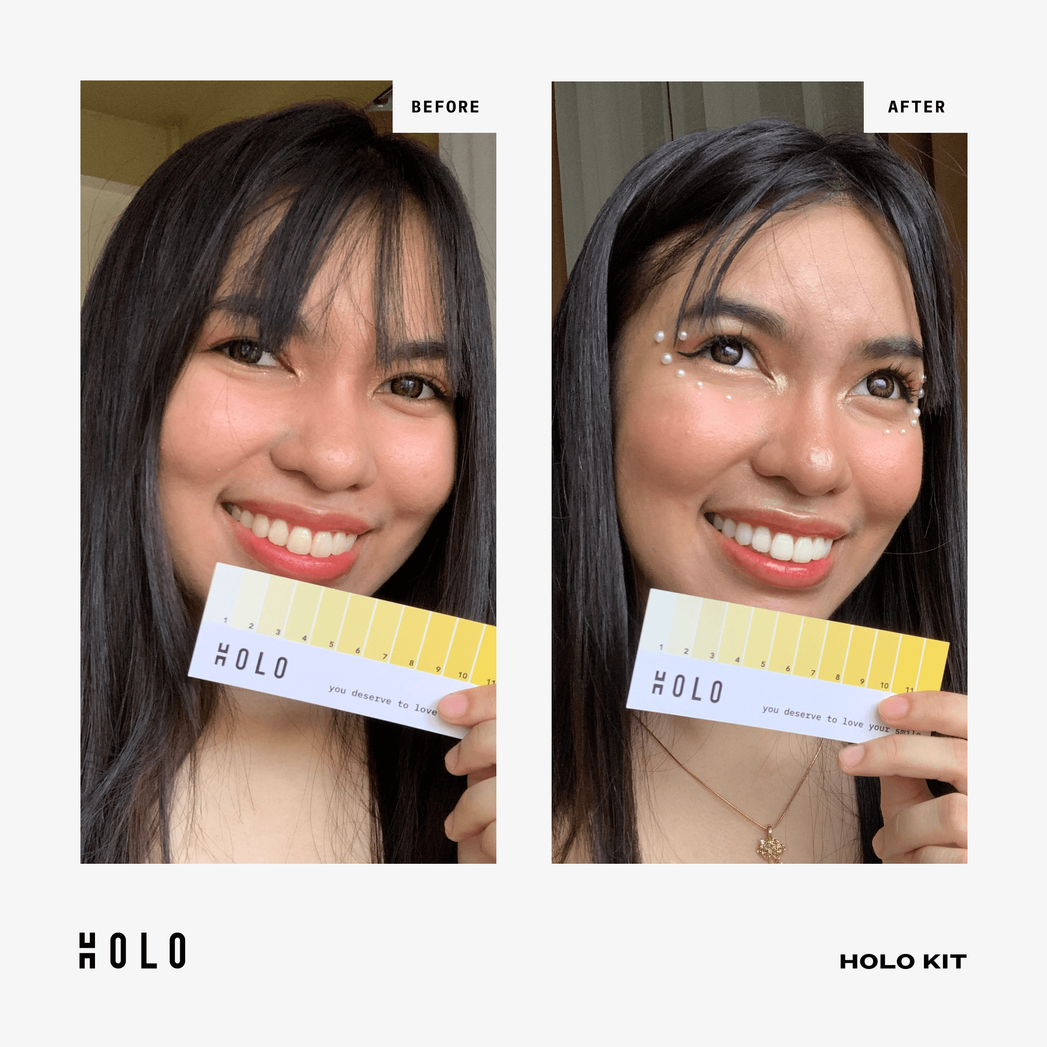 Holo Teeth Whitening Kit Collection